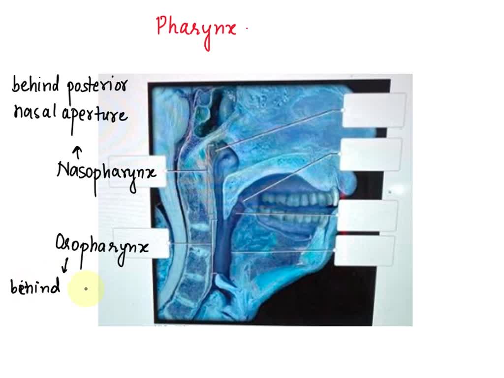 SOLVED: Identify the palates, tongue, tonsils, uvula, and epiglottis ...