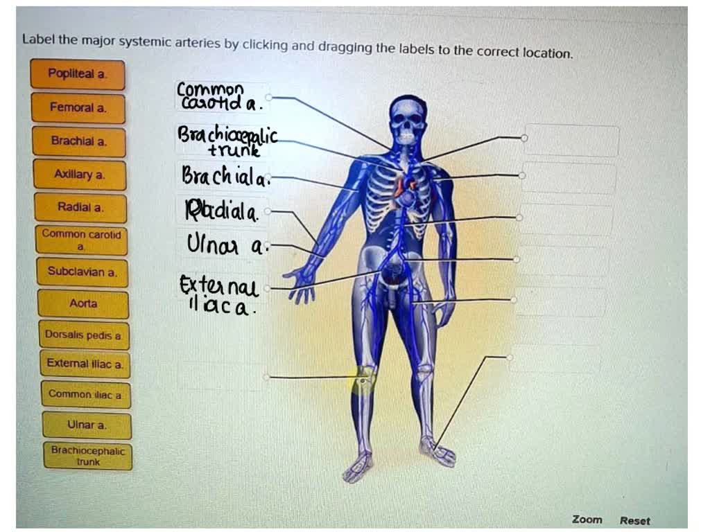 SOLVED: Label the major arteries of the body. (12 points) R common ...