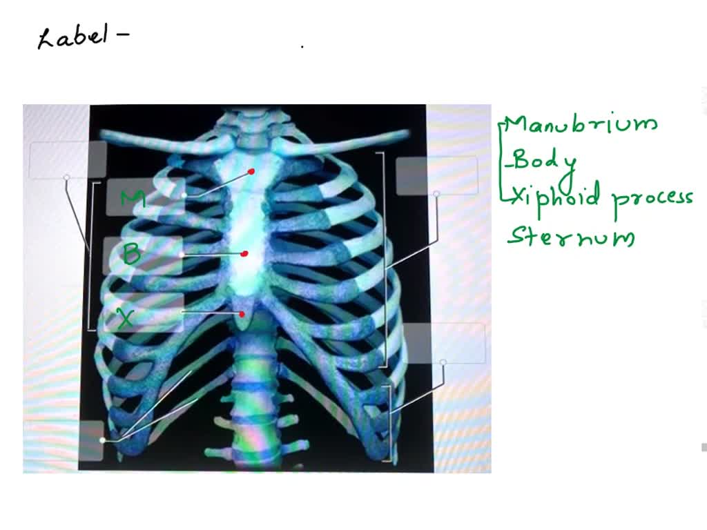 SOLVED: Name the yellow highlighted structures that pass through the ...