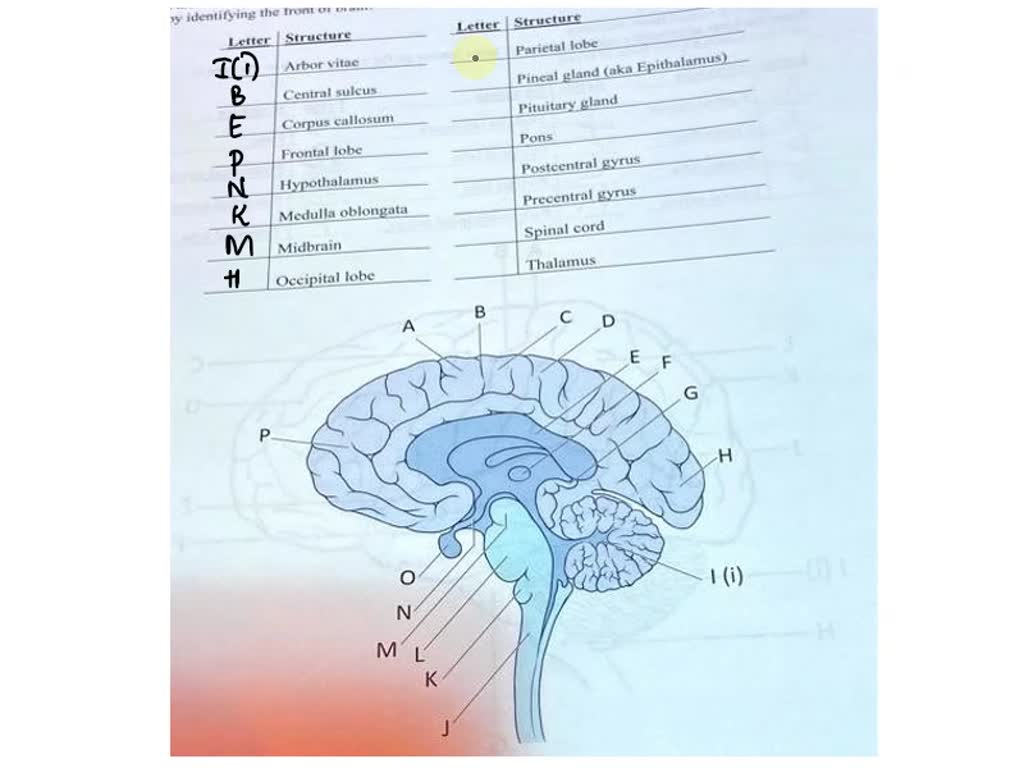 SOLVED: Activity 2: Internal Brain Structure by Identifying the Front of the Brain Letter ...
