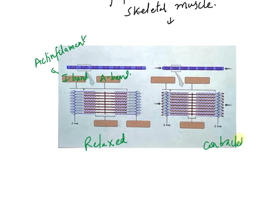SOLVED: Art-labeling Activity: Changes in Sarcomere Appearance during ...