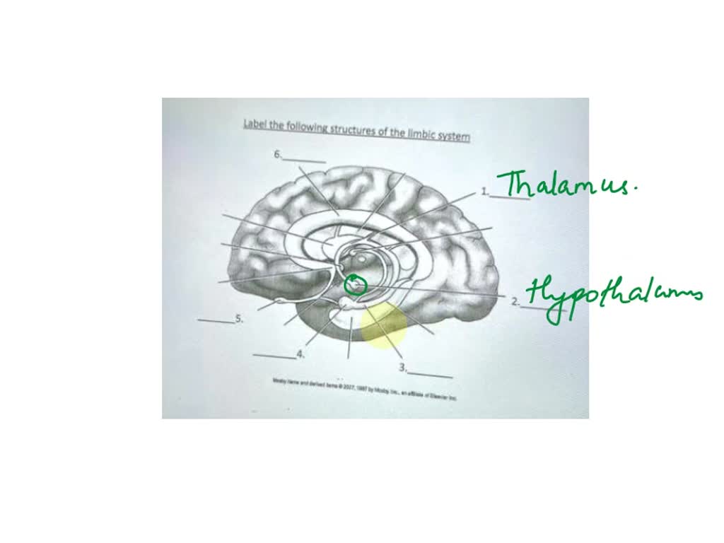 SOLVED: Label the following structures: the region that contains myelinated tracts, the gray ...
