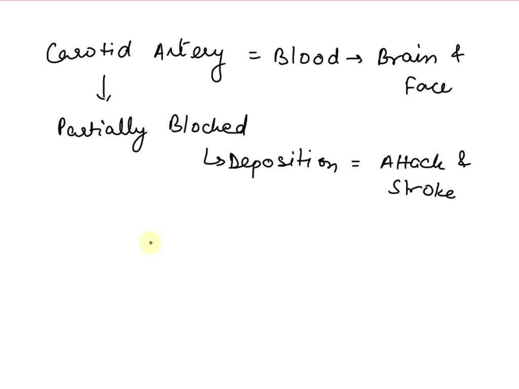 SOLVED: Blood flows through coronary artery that is partially blocked ...