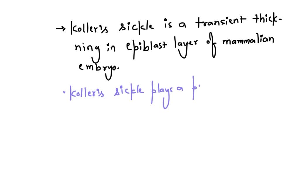 SOLVED: What is Koller’s sickle and what is its importance