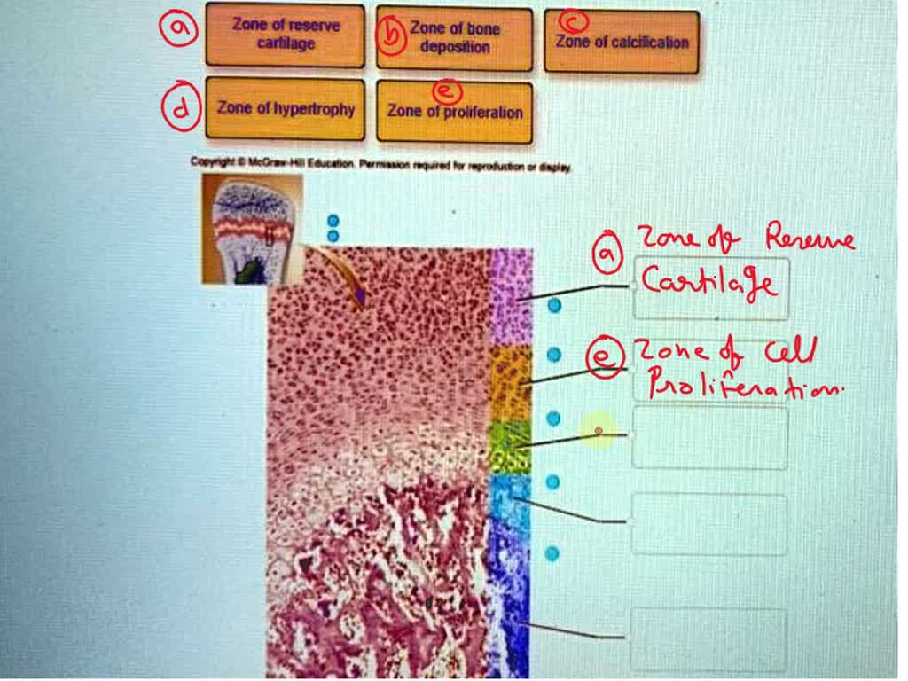 Correctly label the following parts of the growing metaphysis: Zone of ...