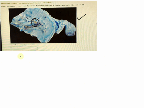 SOLVED: Nervous System>Lab Practical>Question 13 Identify the highlighted region.