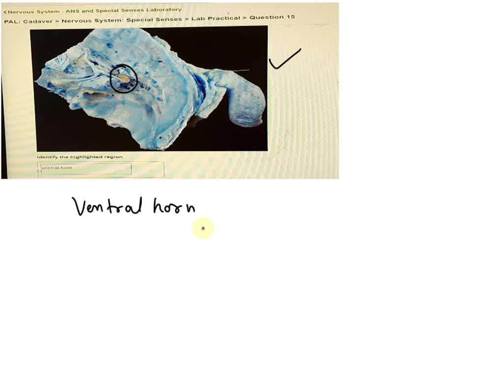SOLVED: Nervous System - ANS and Special Senses Laboratory PAL: Cadaver ... SOLVED: Nervous System - ANS and Special Senses Laboratory PAL: Cadaver ...