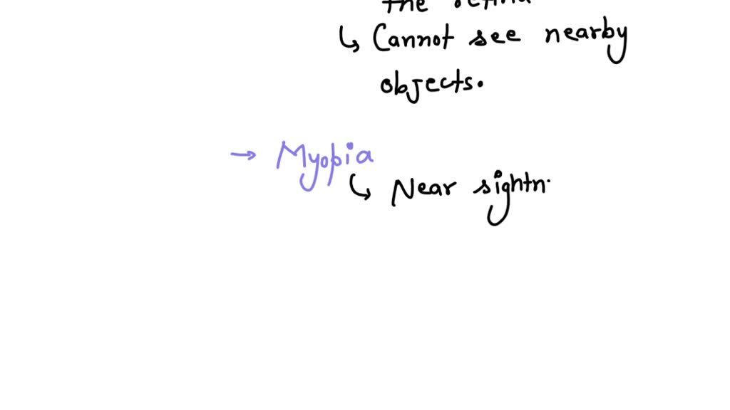 SOLVED: Astigmatism is assessed using a: - pen flashlight - Snellen eye ...