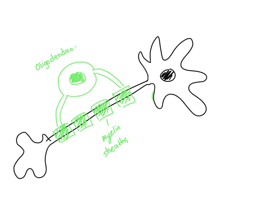 SOLVED: 5. Make a simple drawing of each type of neuron ...