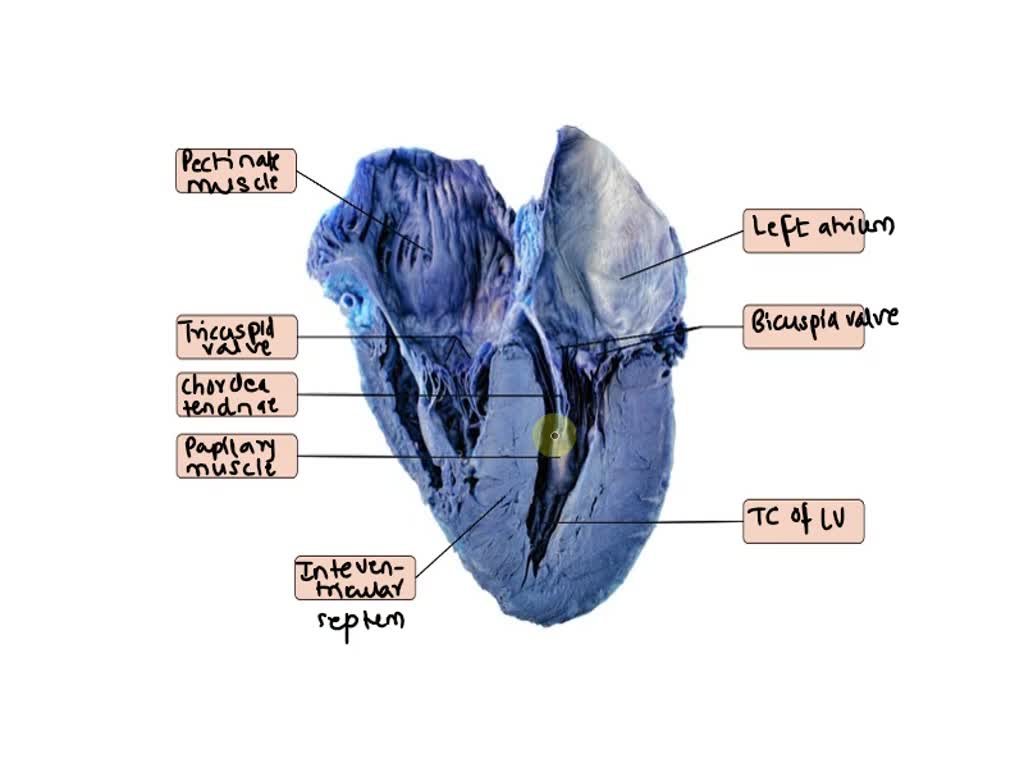 Pectinate Muscles Labeled