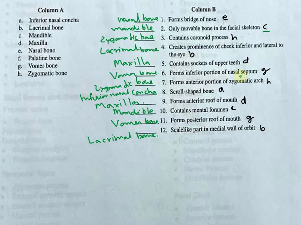 SOLVED: 21. Match the bones in column A with the characteristics in ...