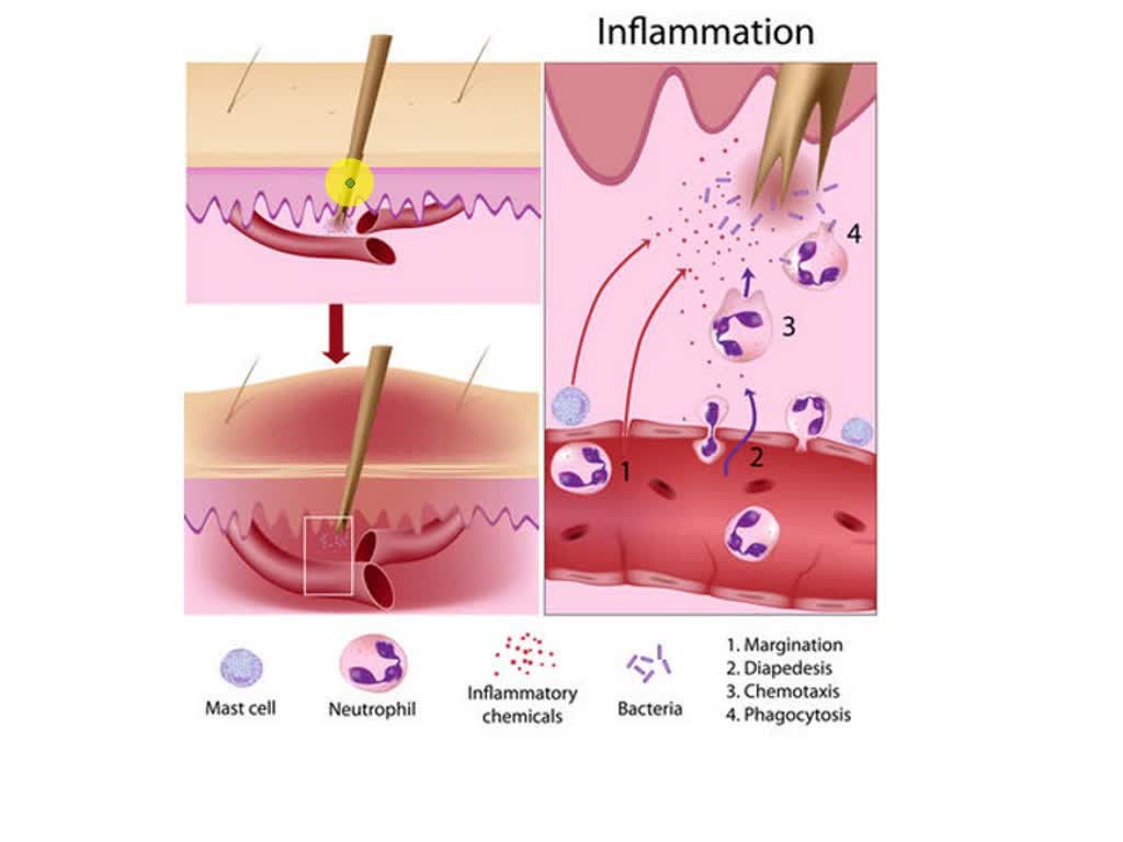 SOLVED: A microbe is introduced into a wound by a splinter. What is the ...