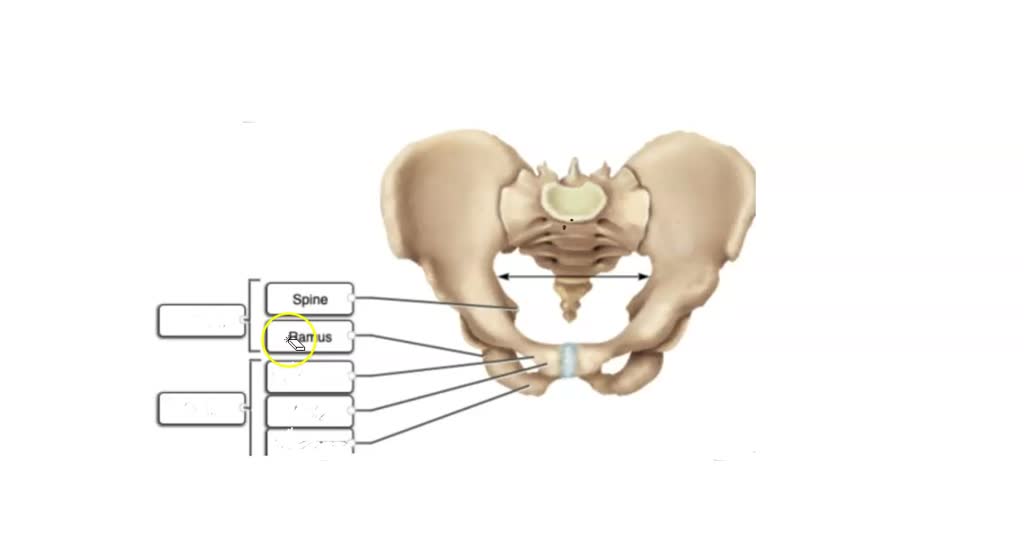 SOLVED: Label the lateral and medial features of the right hip (coxal ...