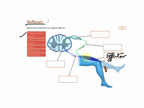 Label the components of a reflex arc in the image below. Dorsal Dorsal root ganglion Motor nerve ...