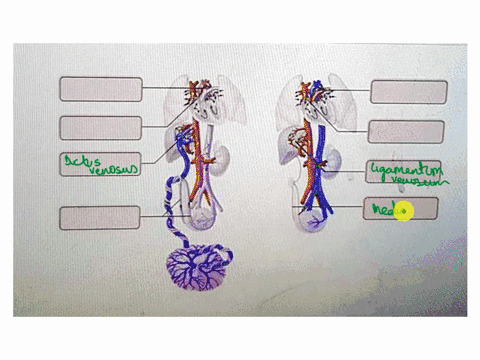Art-labeling Activity: The Anatomy and Orientation of the Pituitary Gland Part A Drag the labels ...