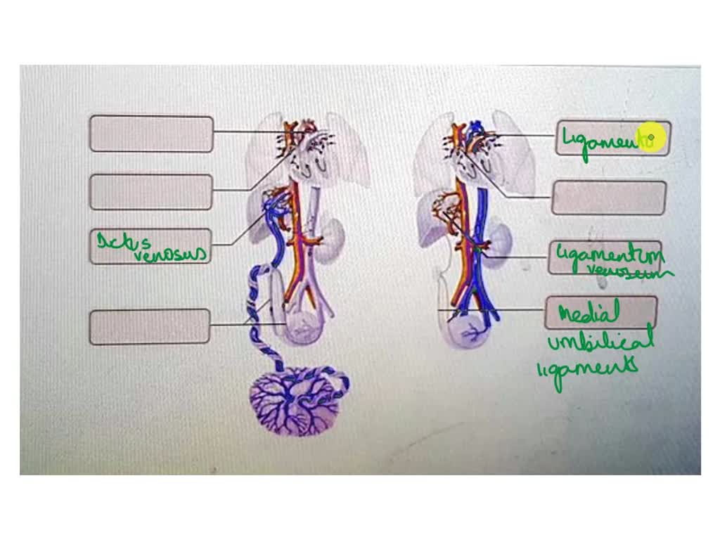 Art-labeling Activity: Figure 32.13a-b Pan A Drag the appropriate ...