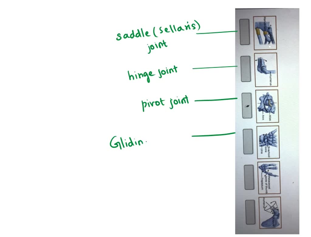 SOLVED: Using Figure to identify each type of synovial joint by name ...