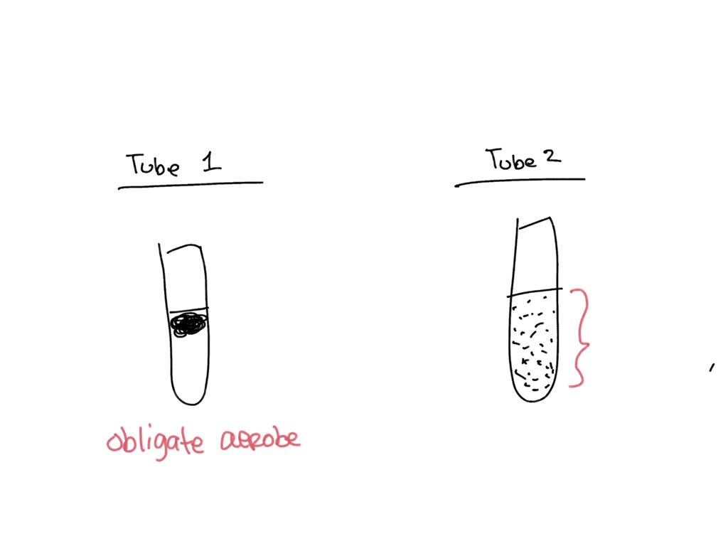 SOLVED: Theory: Bacteria have different oxygen requirements based on ...