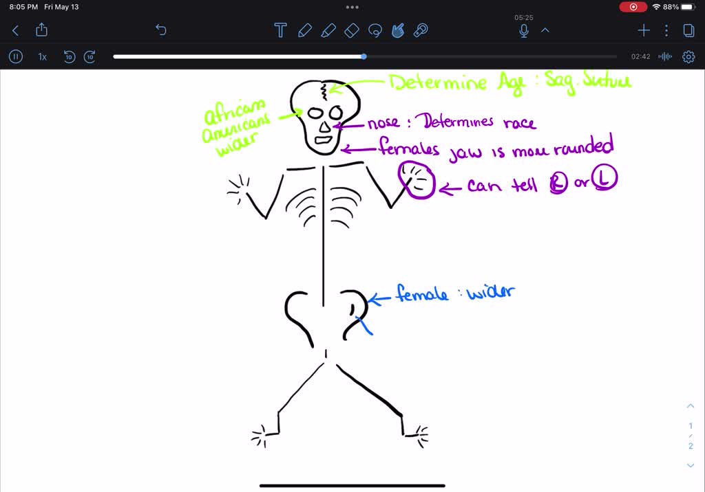 SOLVED: You can tell the age of a skeleton by looking at: A. the length ...
