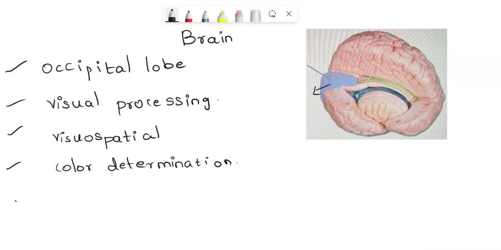 SOLVED: Which structure is highlighted? Multiple Choice insula ...