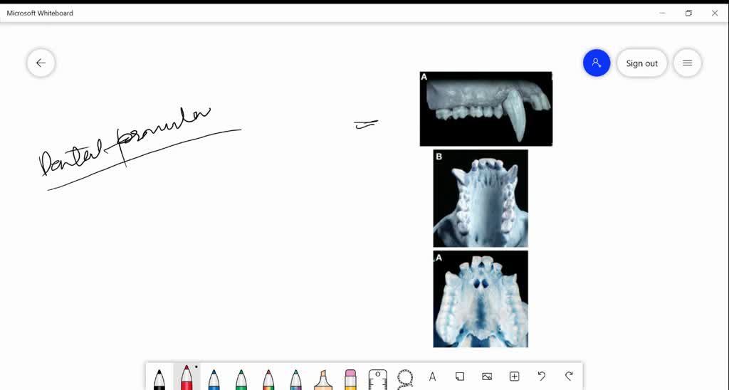 SOLVED: Dental Formula A dental formula states the number of each type ...