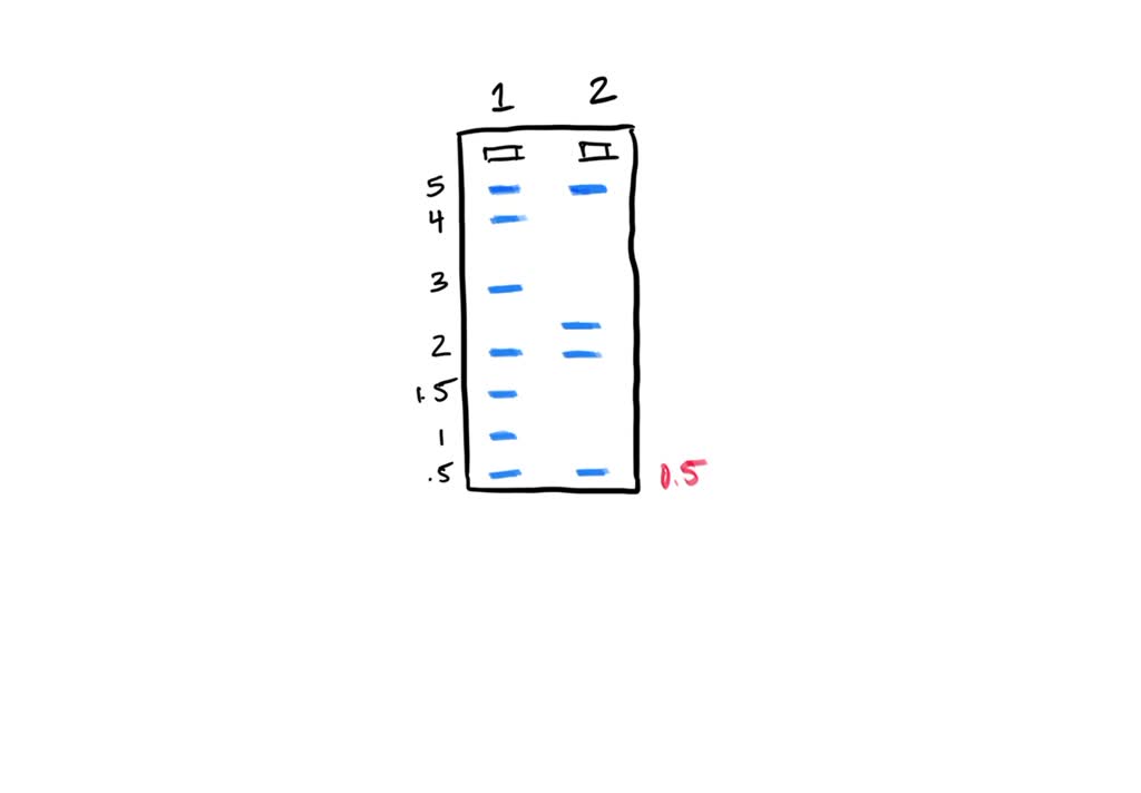 SOLVED: The following image represents the agarose gel electrophoresis ...