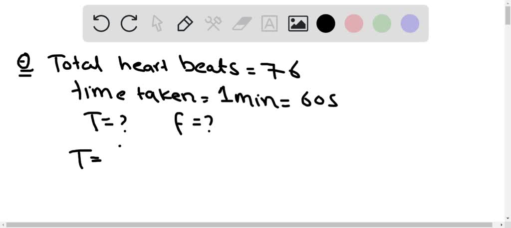 SOLVED: Using the 6-second method, estimate the heart rate from this ...