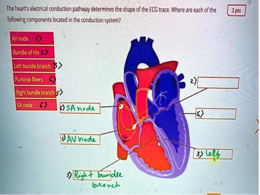 SOLVED: The heart's electrical conduction pathway determines the shape ...