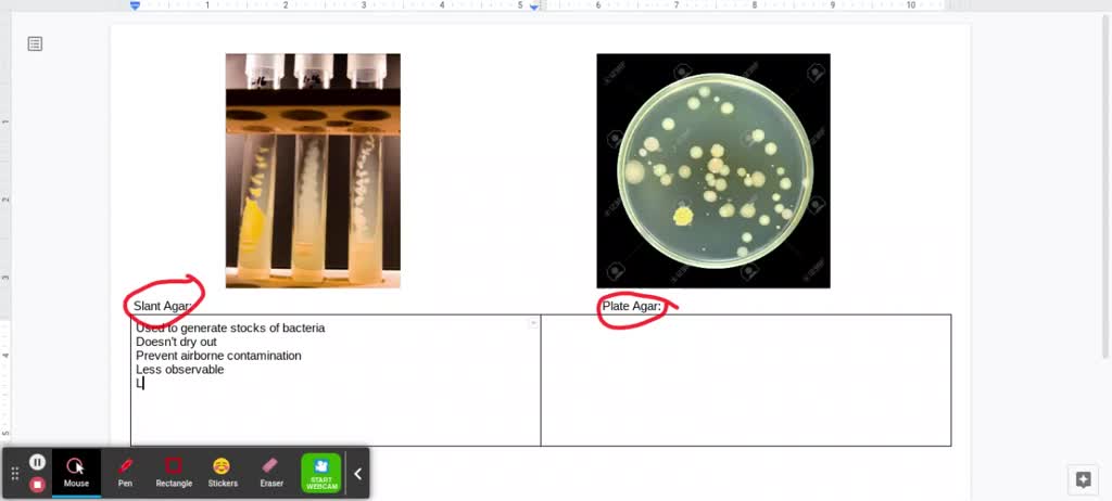 SOLVED: Why is the Snyder test agar in a deep and not a slant?