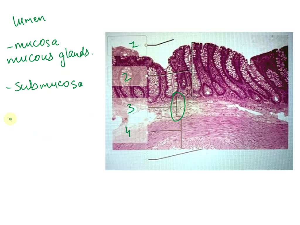 SOLVED: Label the mucosa and submucosa of the large intestine wall by ...