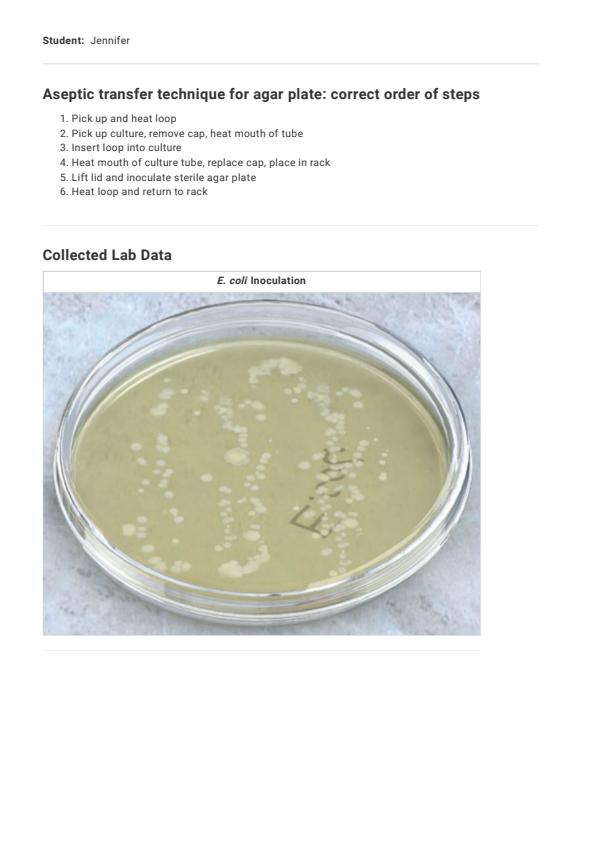 SOLVED: You expose an agar plate to the environment and get good growth. A number of colonies ...