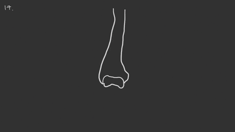 SOLVED:Which region of the humerus articulates with the radius as part ...