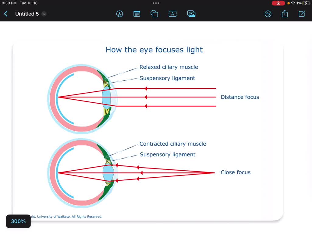 SOLVED:How does the eye adjust the focusing of light by accommodation ...