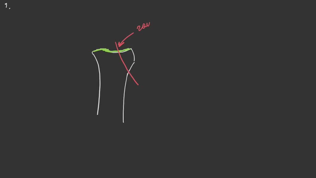 SOLVED:Watch this video (http://openstaxcollege.org/I/ fractures) to see how fractures of the ...