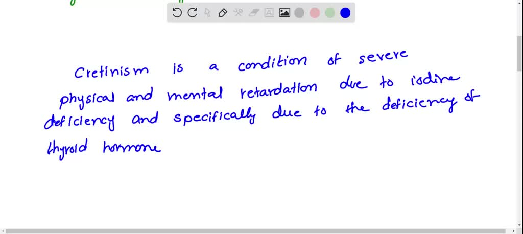 Assertion: Failure of secretion of thyroid gland hormones from ...