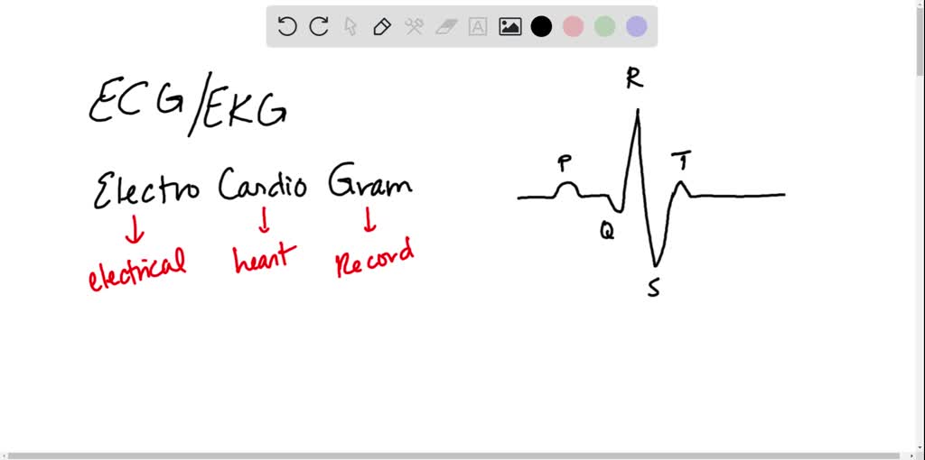 SOLVED:An ECG provides information about (a) cardiac output, (b ...