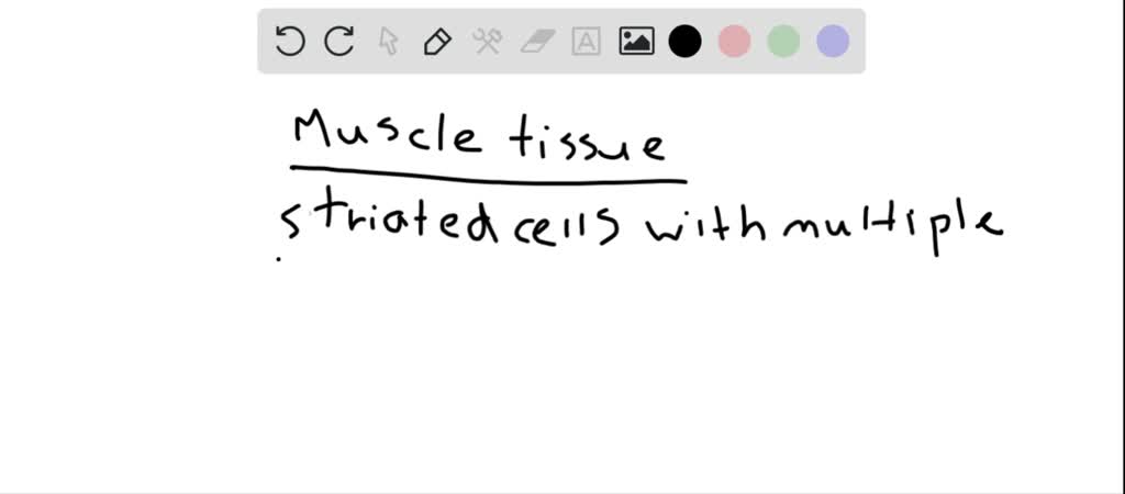 Which type of tissue is multinucleated? a. Skeletal muscle tissue b ...