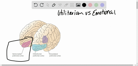 SOLVED: After damage to the ventromedial prefrontal cortex, what ...