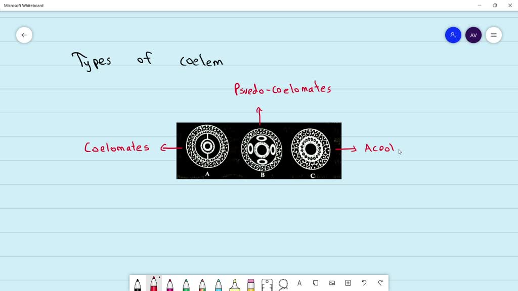 SOLVED:The figures given below show the types of coelom. Identify them ...