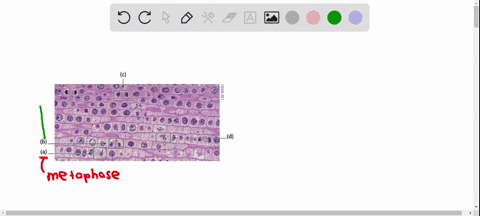 SOLVED:You prepare a slide with a thin slice of an onion root tip. You see the following view in ...