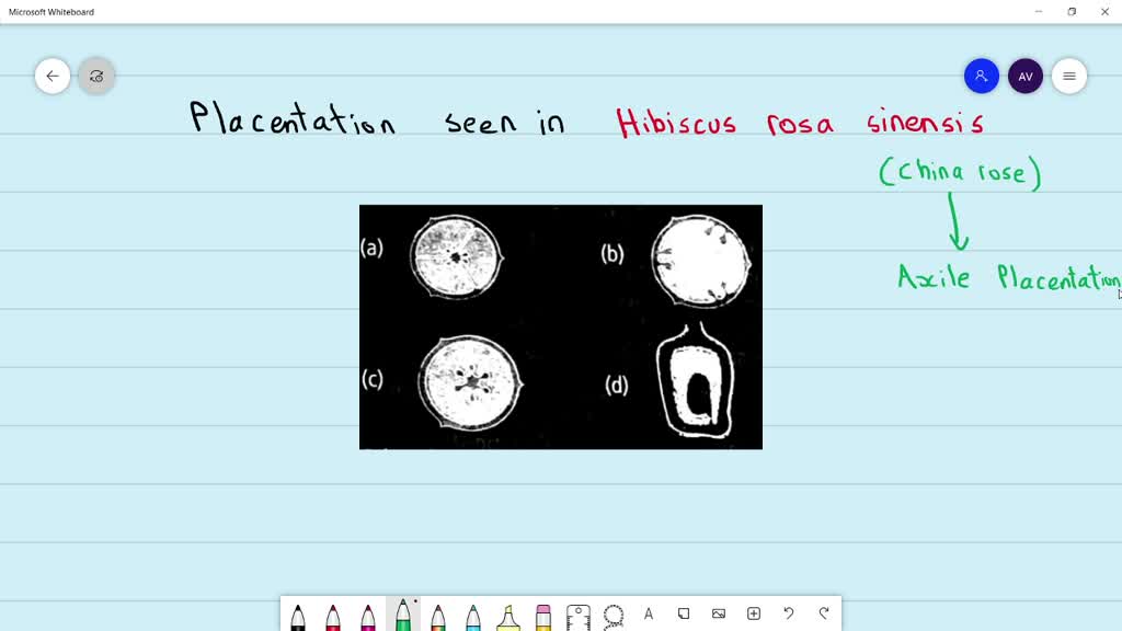 SOLVED: Which of the following figures represent a typical placentation ...