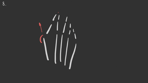 SOLVED:View this link (http://openstaxcollege.org/1/bunion) to learn about a bunion, a localized ...