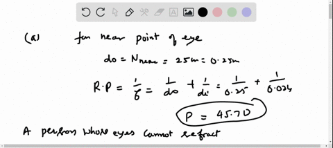 SOLVED:The greatest refractive power a patient's eyes can produce is 44 ...