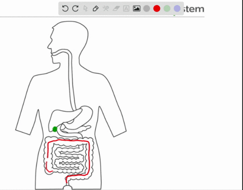 SOLVED:The D-xylose absorption test is particularly helpful in ...