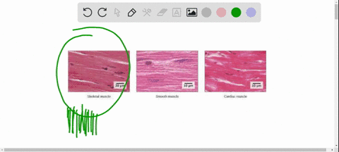 SOLVED:Which muscle types appear striated under a microscope? a ...