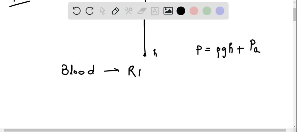 ⏩SOLVED:Why don't his lungs, heart, and chest completely collapse ...
