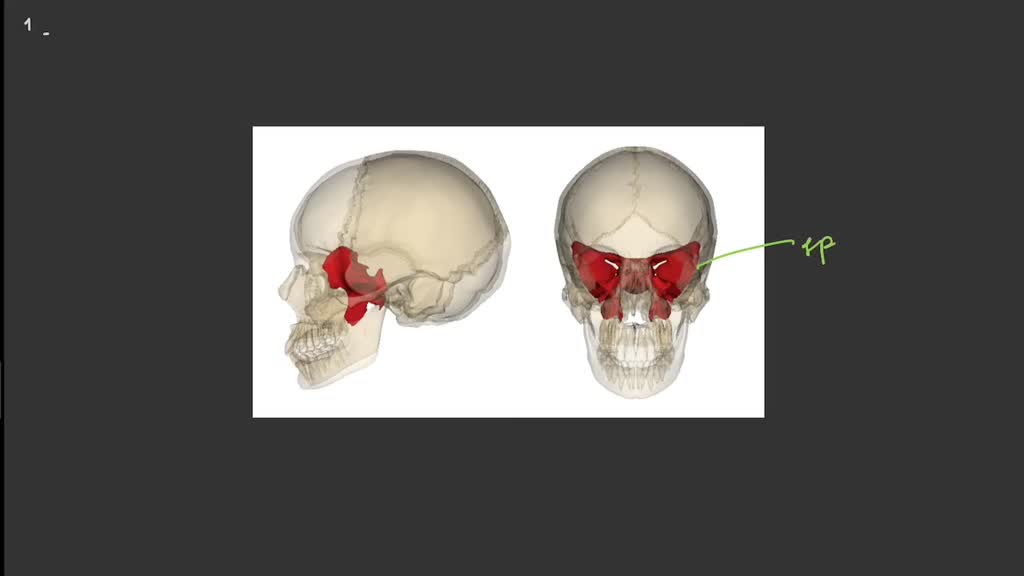 SOLVED:Watch this video (http://openstaxcollege.org/lskull1) to view a rotating and exploded ...