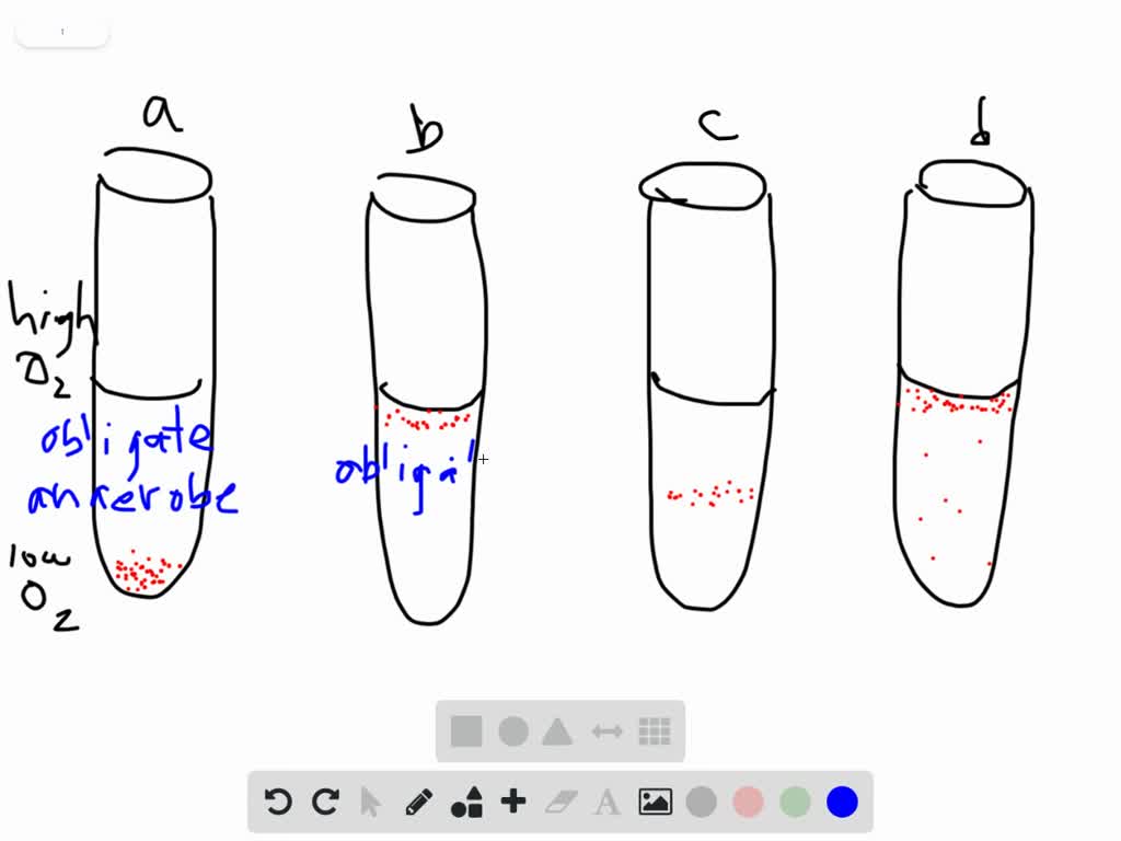 SOLVED:Four tubes are illustrated with cultures grown in a medium that ...