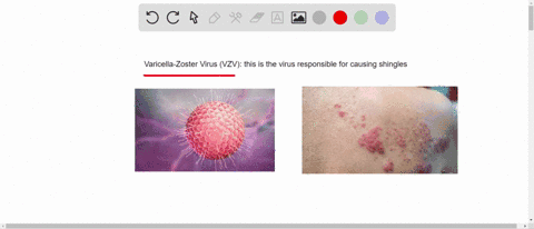 ⏩SOLVED:Adults who have had varicella as children occasionally… | Numerade