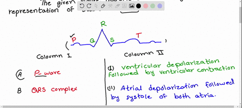 SOLVED:(a) Suggest a diagnosis for the ECG recording in Fig. 12.56 ...